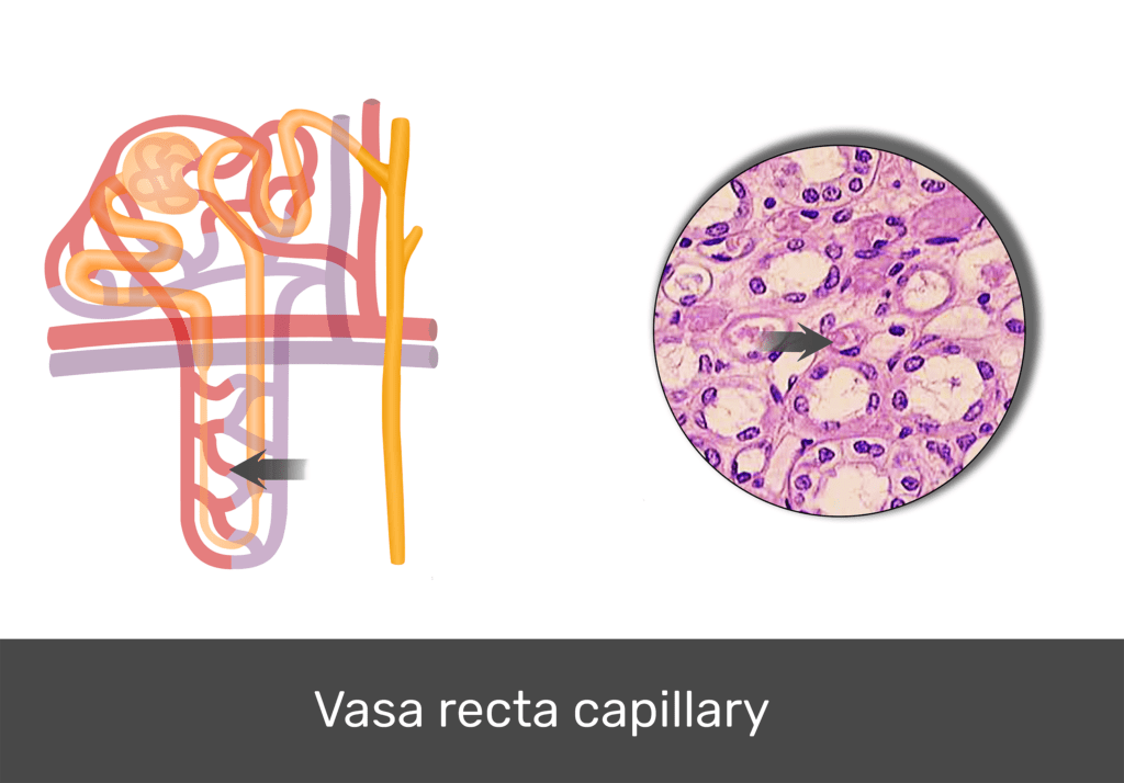 Vasa Recta