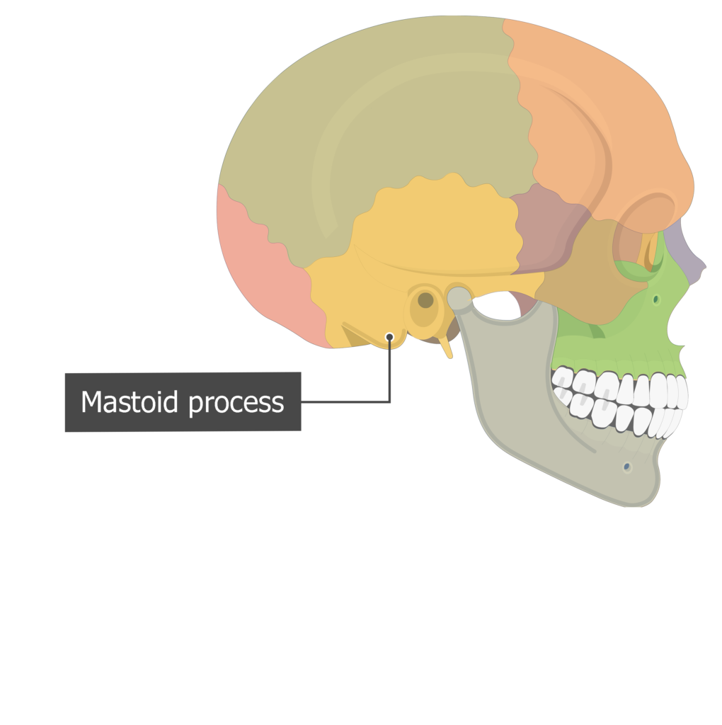 Mastoid Process Of Temporal Bone Anatomical Variation In Mastoidectomy