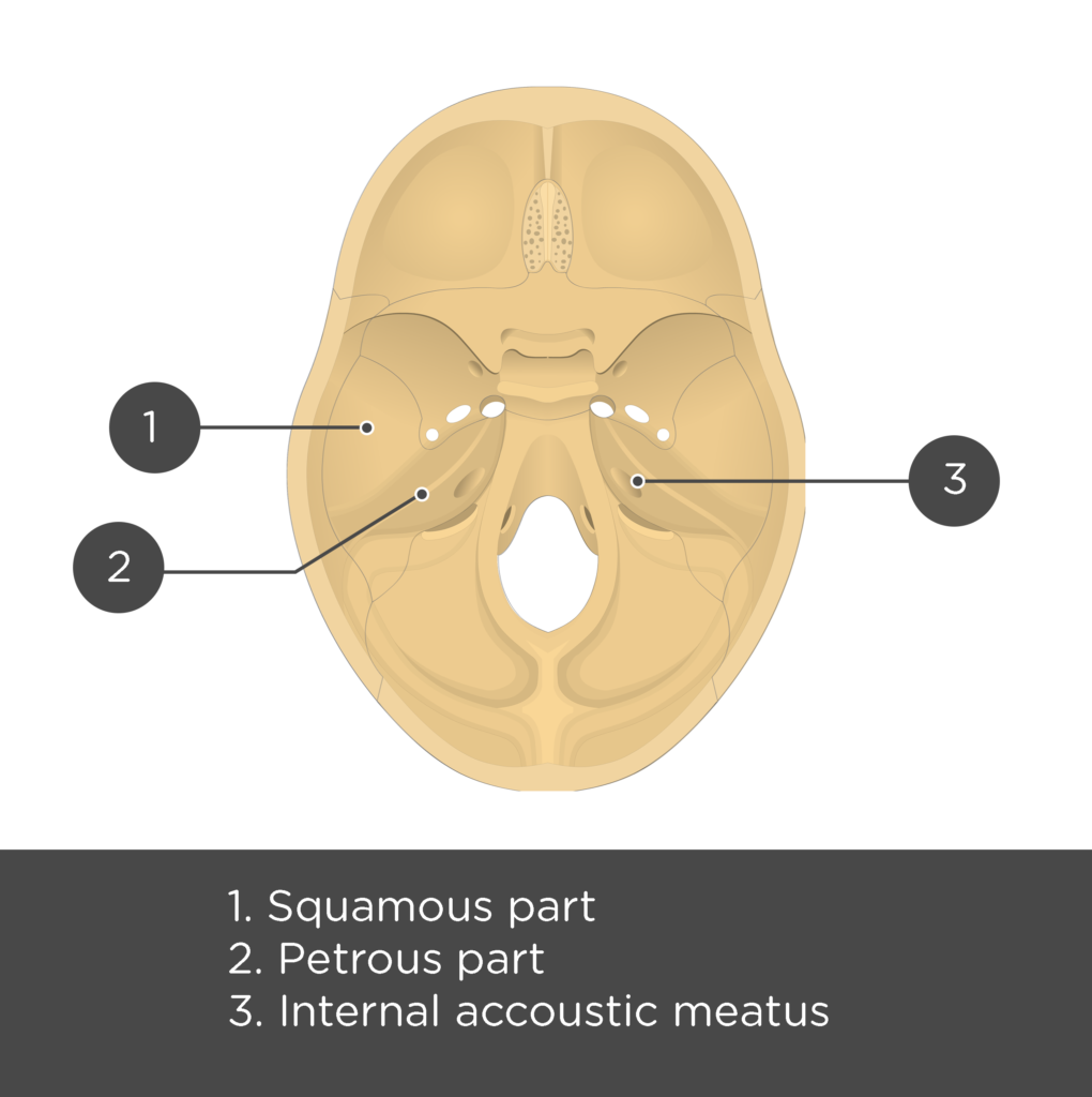 Petrous Temporal Bone Petrous Temporal Bone