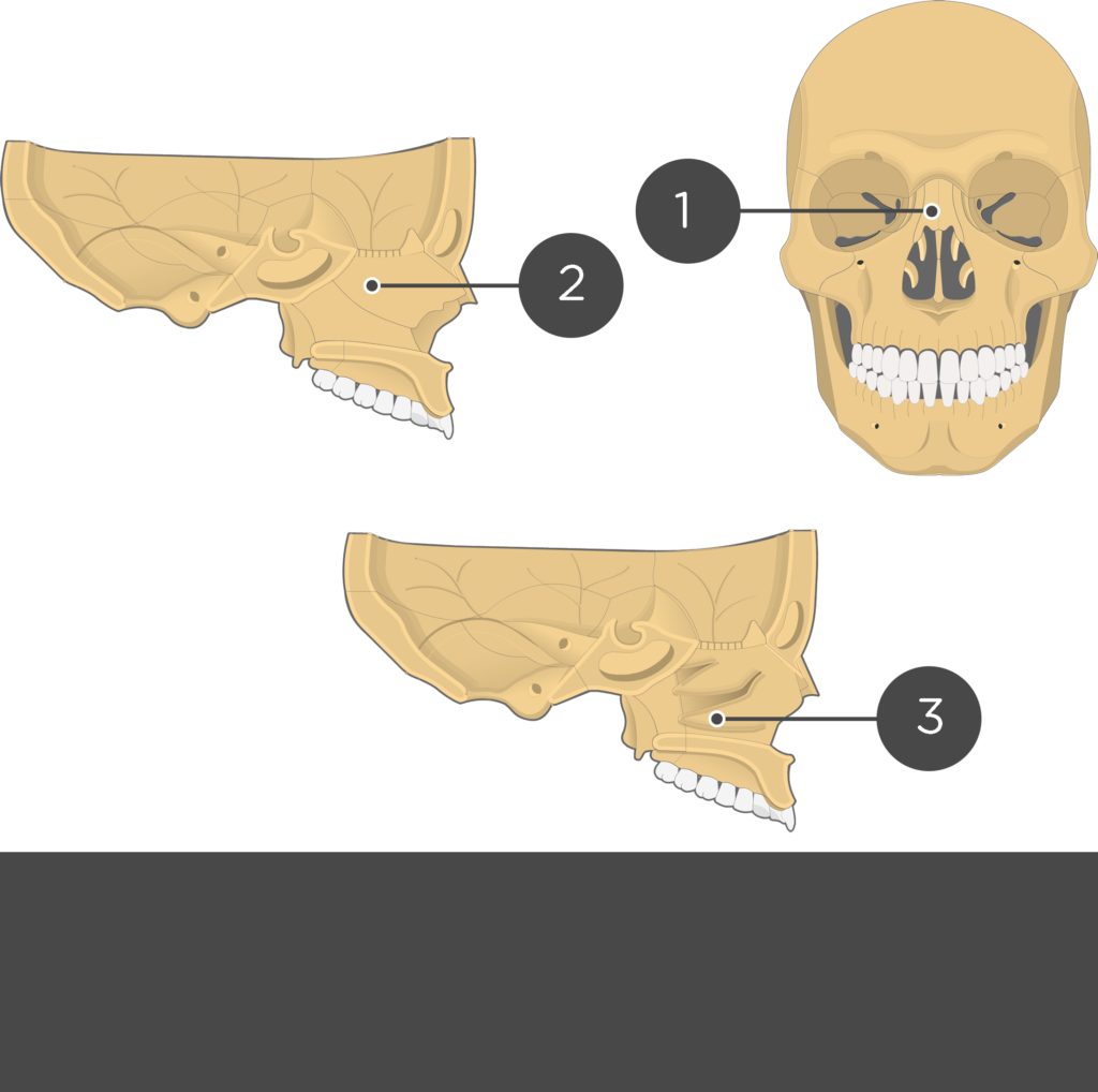 Vomer Bone Anatomy Sphenovomerine Suture E Anatomy IMAIOS