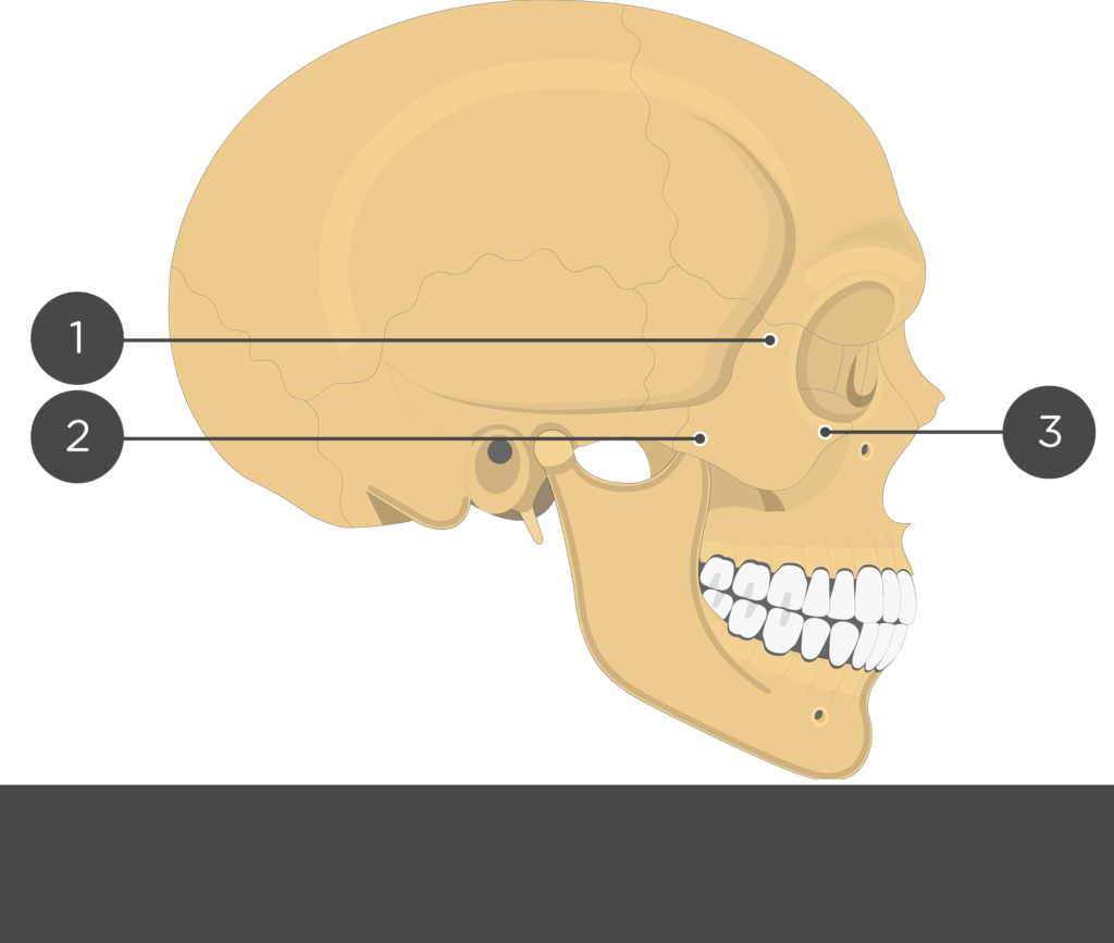Zygomatic Process Of Frontal Bone Zygomatic Bone (Cheekbone)