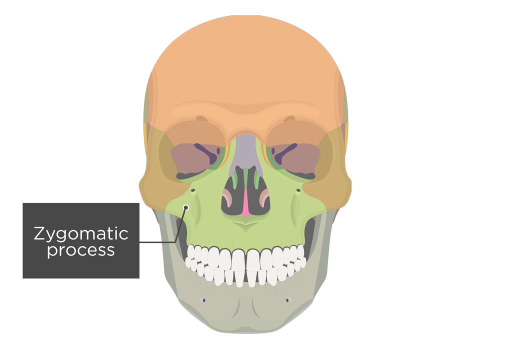 Maxillary Process Of The Zygomatic Bone
