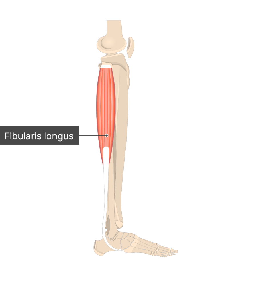 Fibularis Longus Tendon Diagnosis And Treatment Of Peroneal Tendon