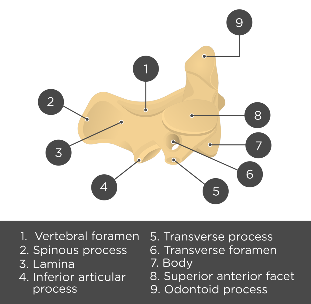 Odontoid Vertebra