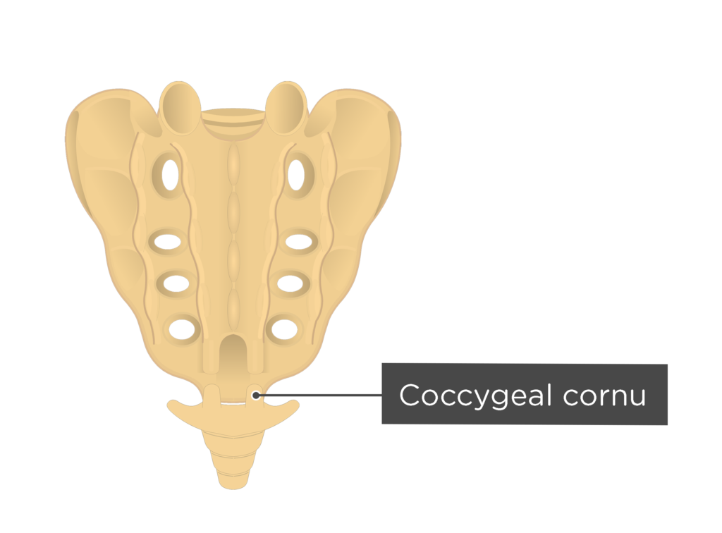 Coccygeal Cornua