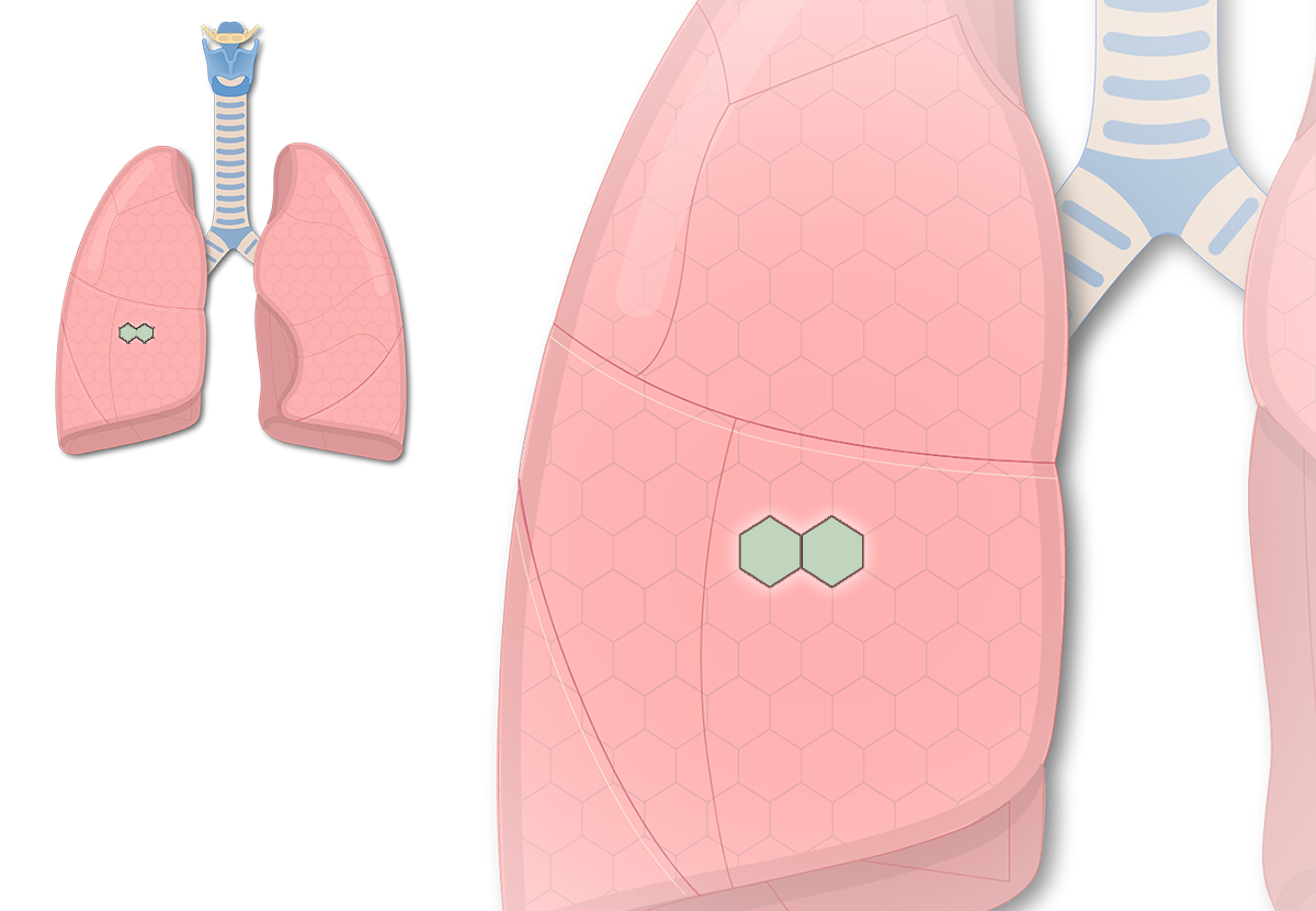 Secondary lung lobules | GetBodySmart