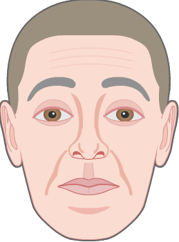 Frontalis Muscle - Attachments, Actions & Innervation | GetBodySmart