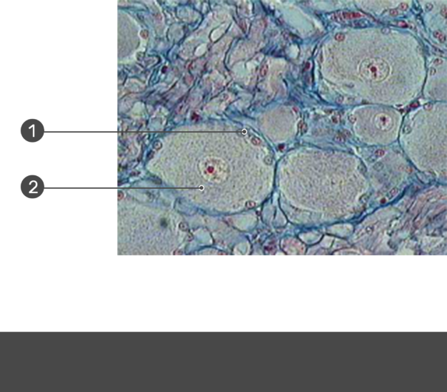 Satellite Cells - Location, Structure, and Function | GetBodySmart