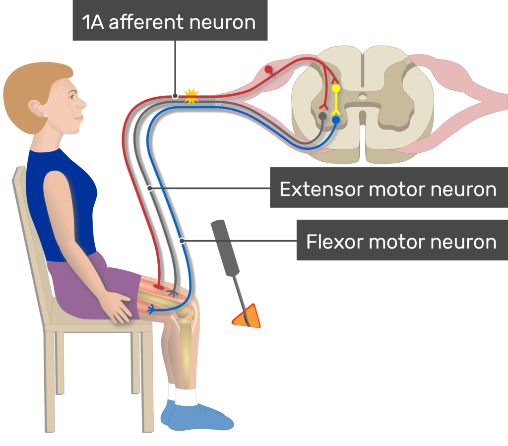 Flexion Reflex Arc