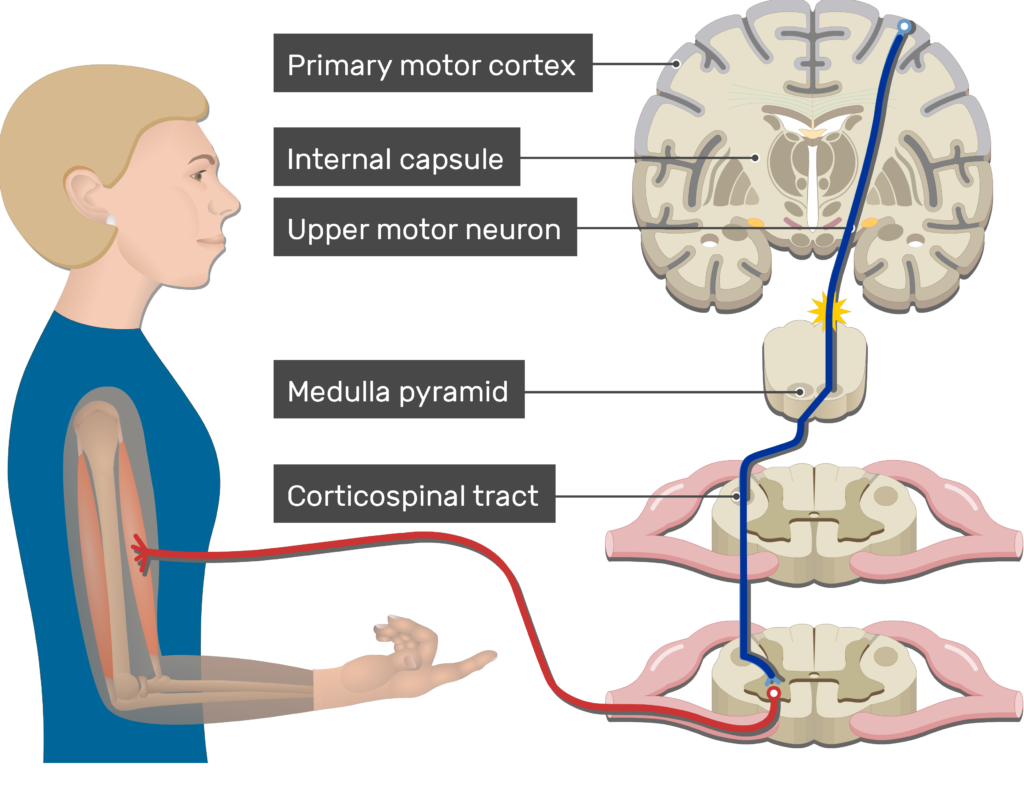 Corticospinal Tract Pathway