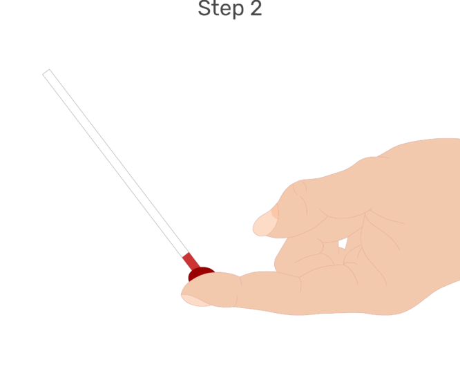 Clotting time test | GetBodySmart