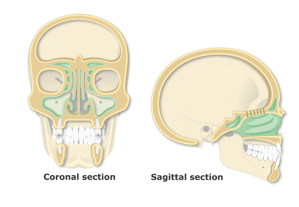 Vestibule Region of the Nasal Cavity