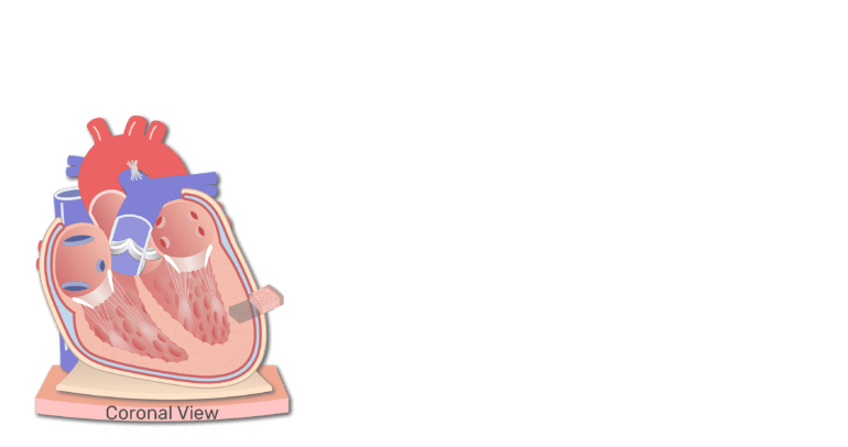 Layers of the heart wall and labeled diagram | GetBodySmart