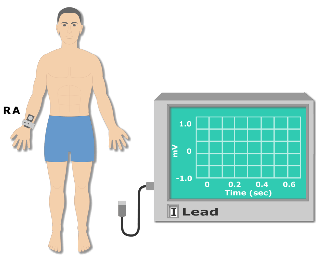 5 Lead Ecg Placement