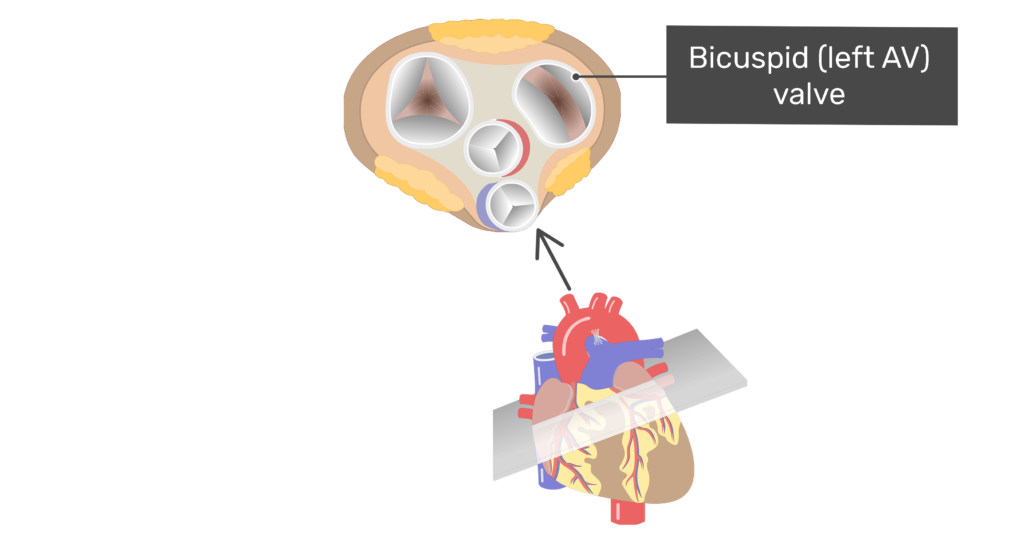 Bicuspid Valve Location