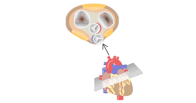 Heart Valves: Anatomy and Function | GetBodySmart