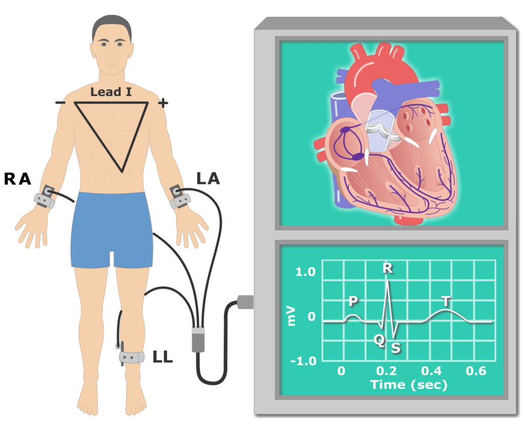 The Electrocardiogram (EKG or ECG): animation and diagram | GetBodySmart