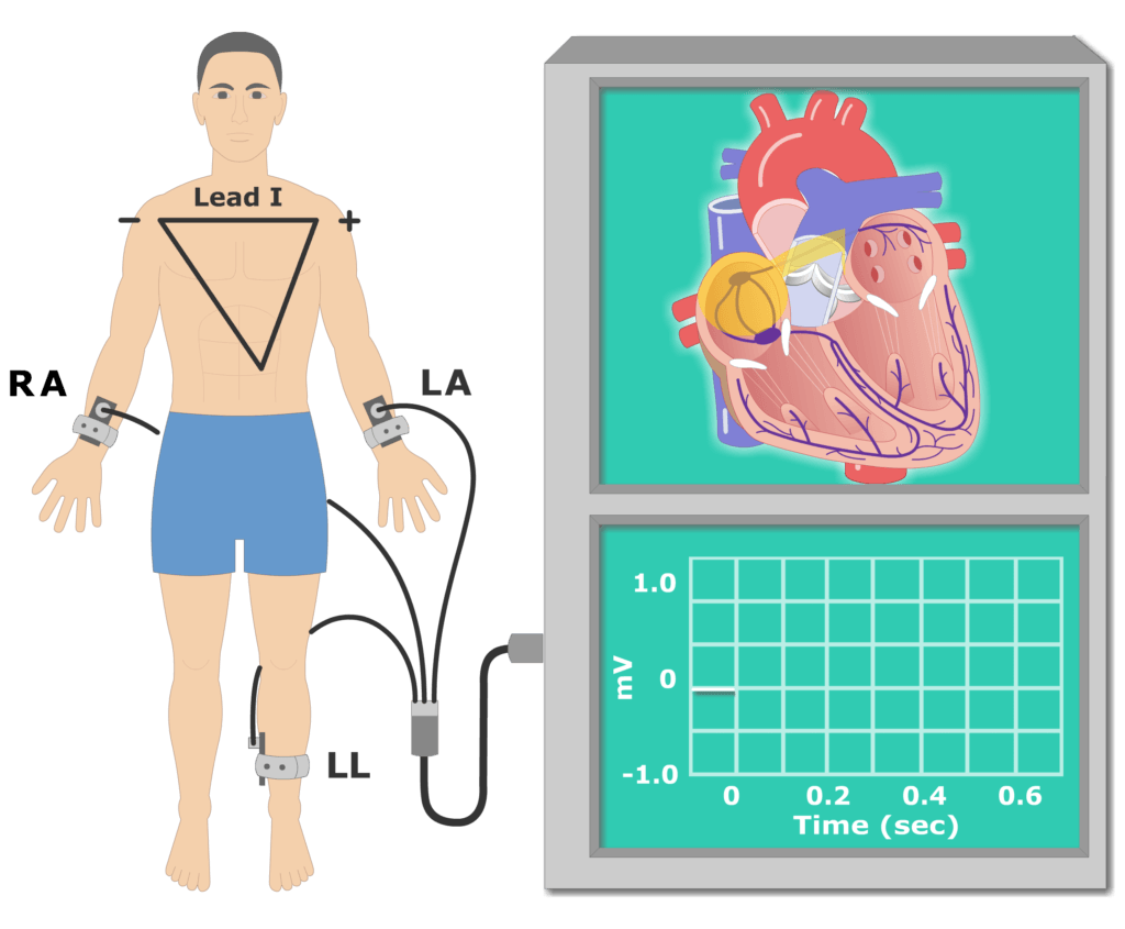 Normal Ekg Clipart