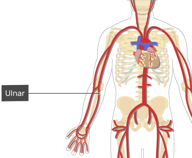 Major systemic arteries of the body | GetBodySmart