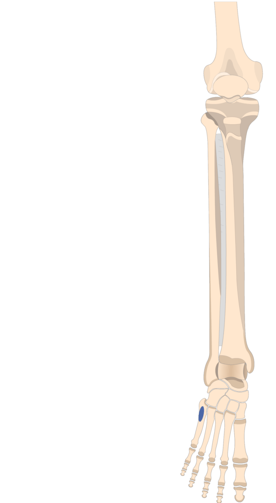 Fibularis (Peroneus) Tertius Muscle - Attachments, Actions ...