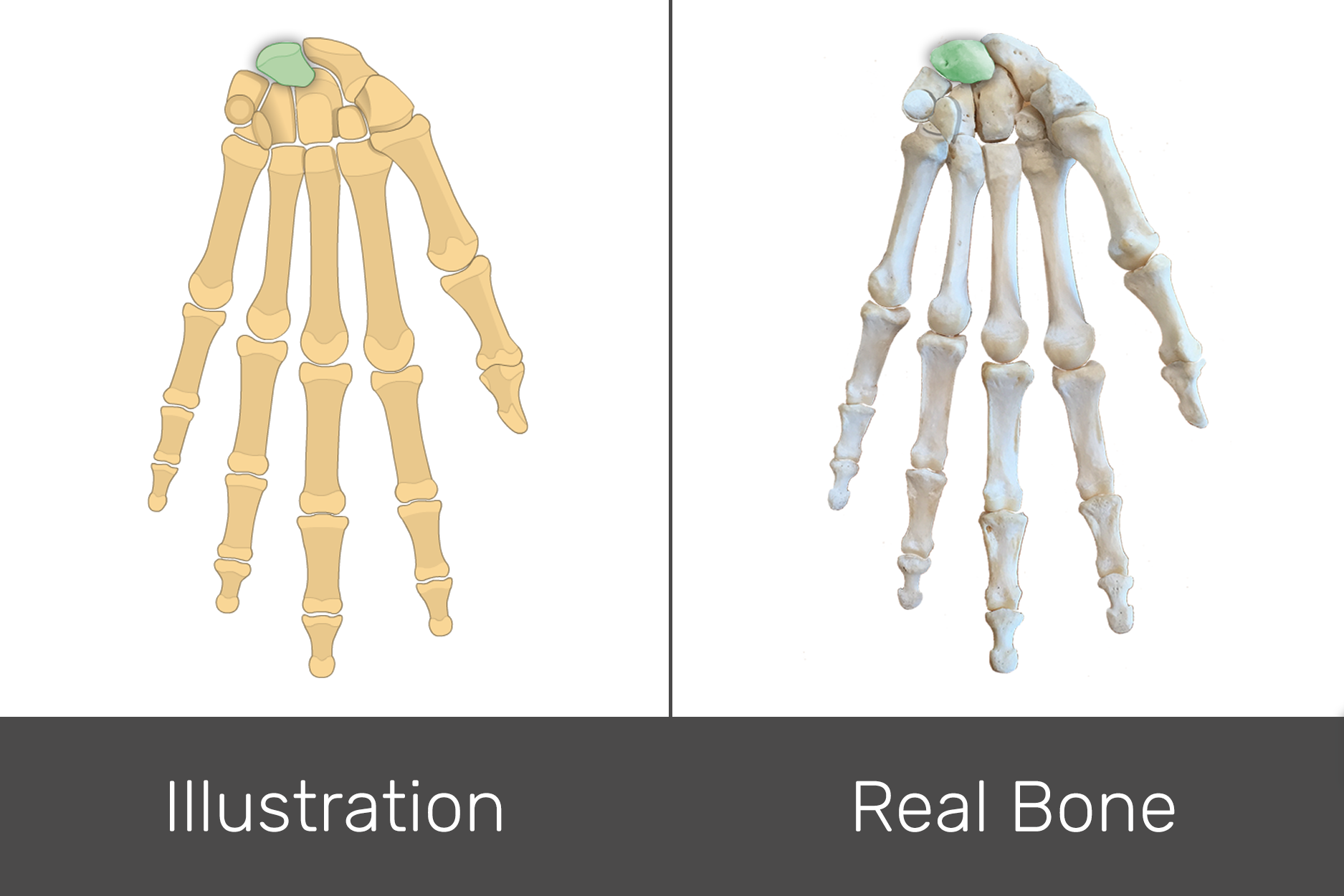 Right Anterior Hand Bones