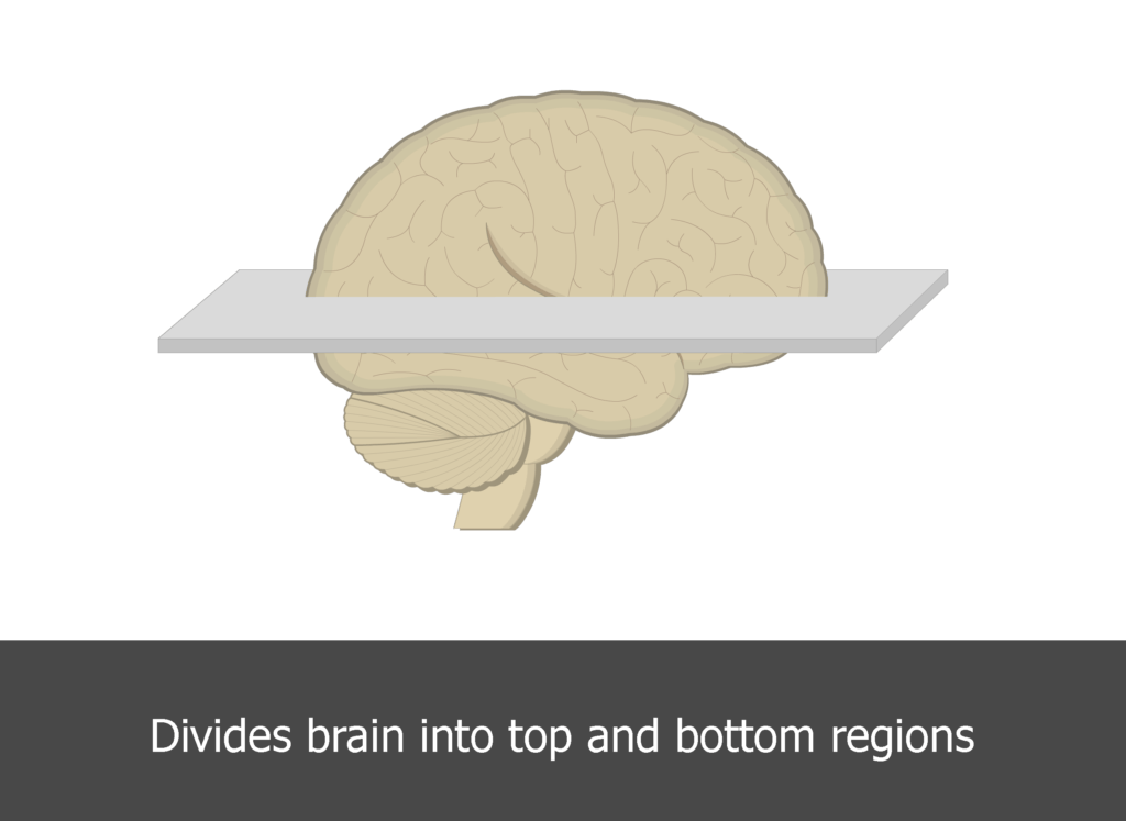 Horizontal View Of Brain