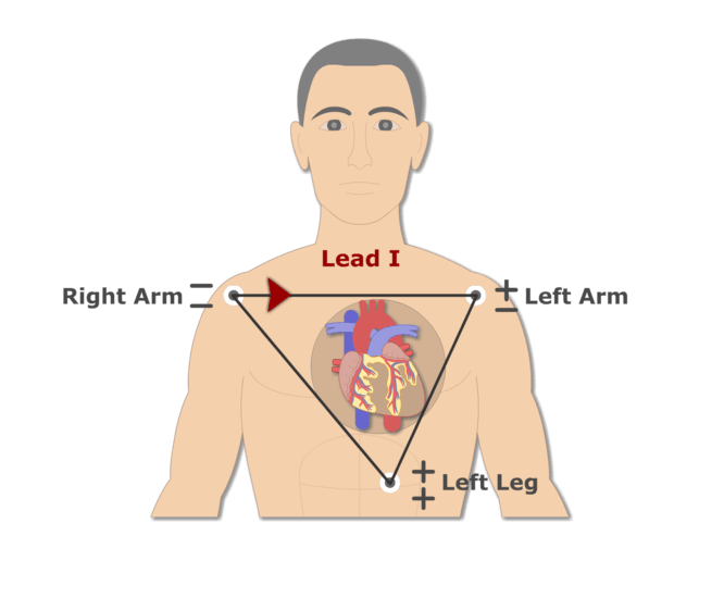 ECG Electrode Placement | GetBodySmart