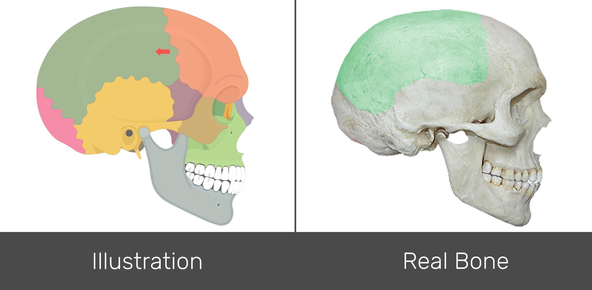 Parietal Bone Anatomy Quiz