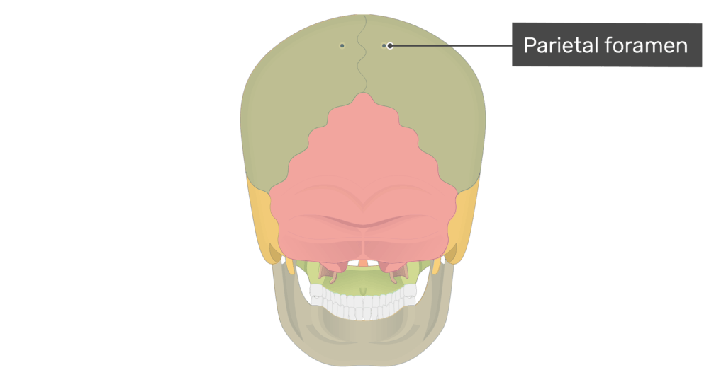 Parietal Foramen