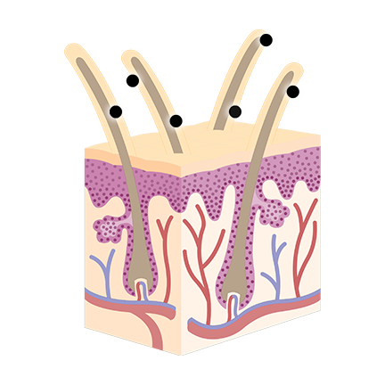 Vestibule Region of the Nasal Cavity