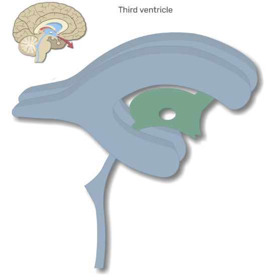Ventricles of the Brain: labeled diagram | GetBodySmart