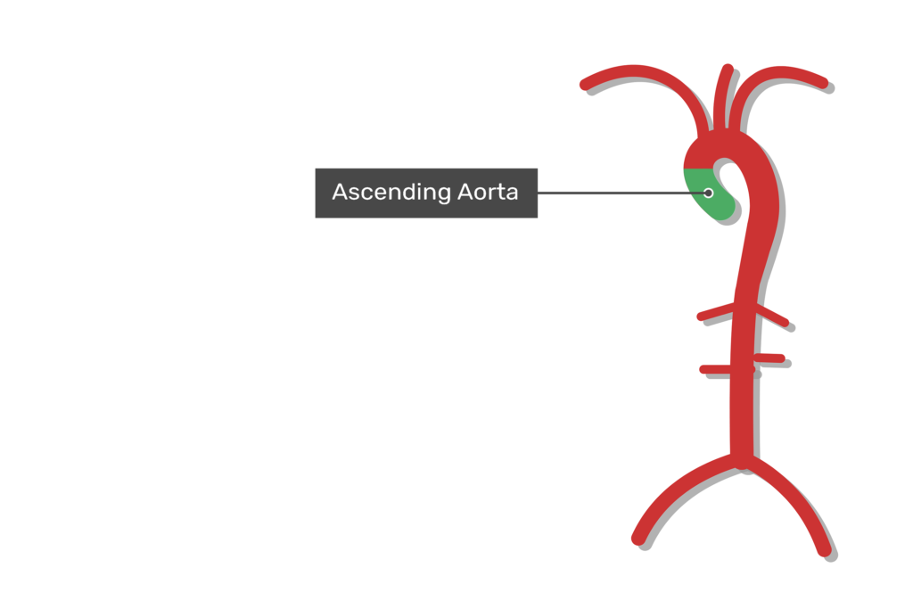 Ascending And Descending Aorta