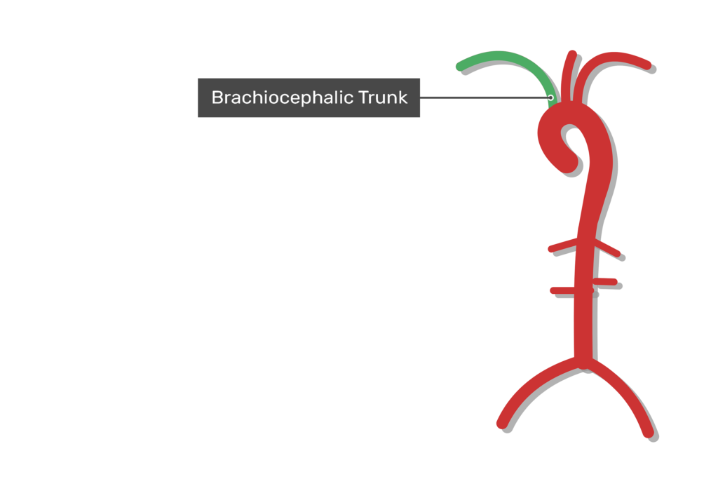 Brachiocephalic Trunk