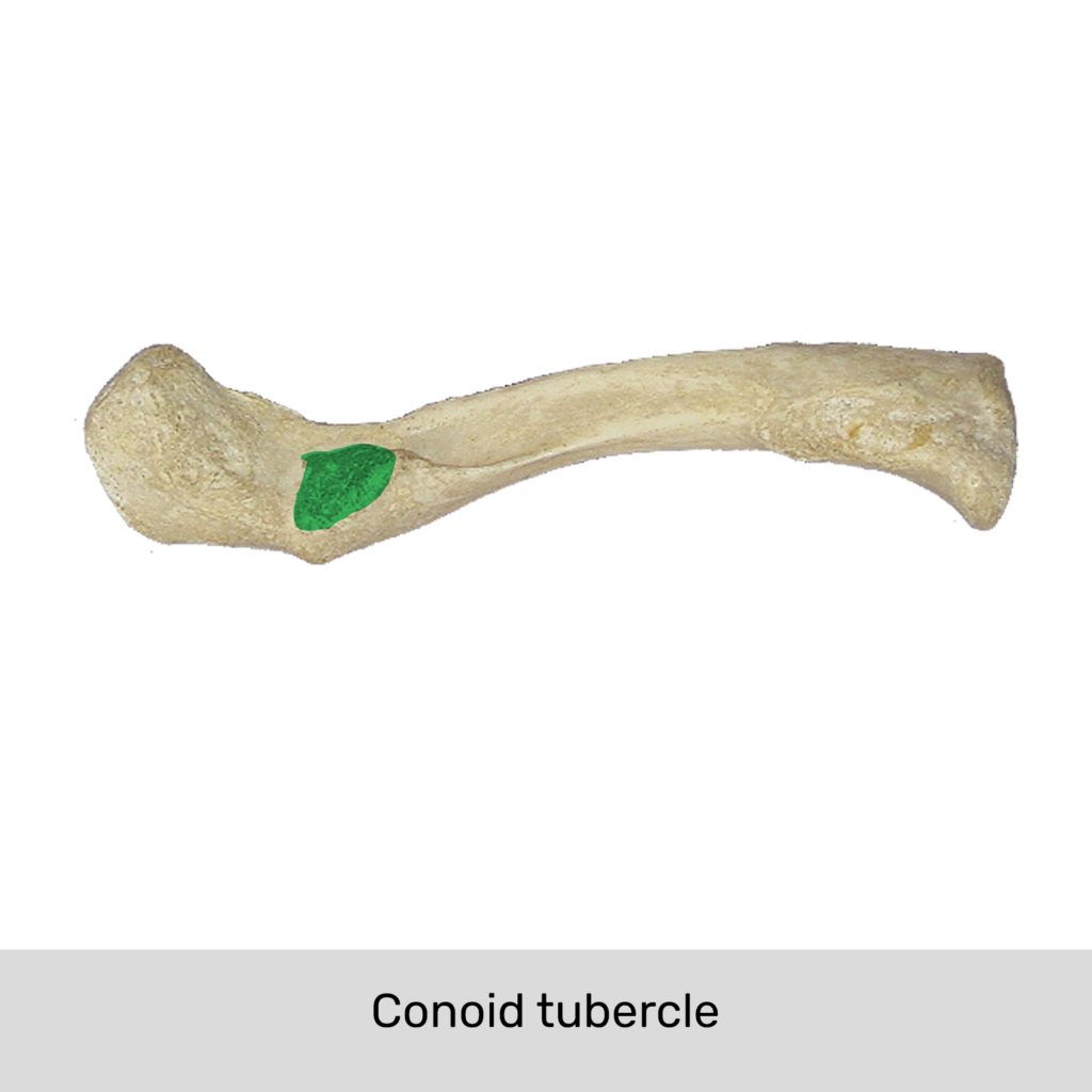 Clavicle Conoid Tubercle