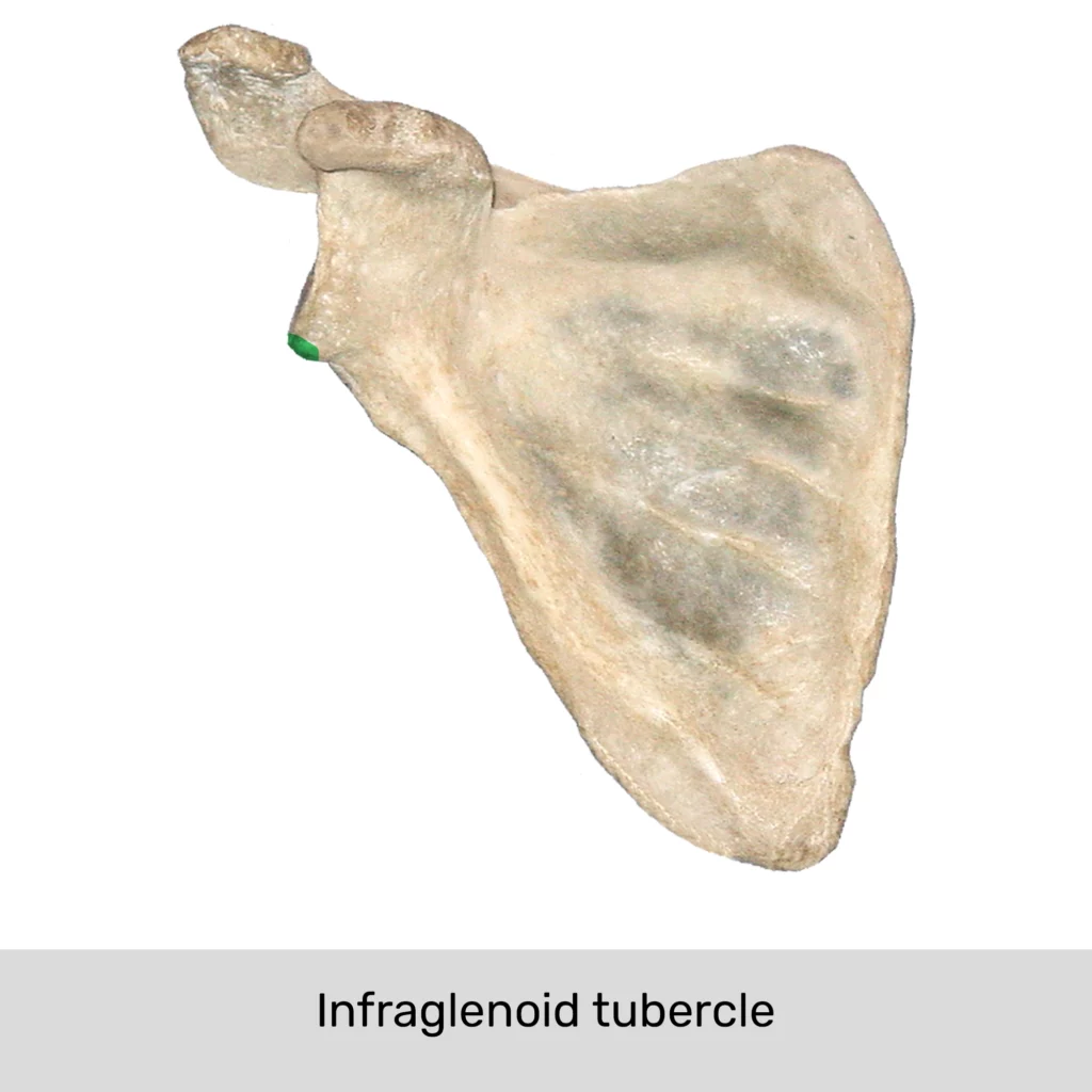 Infraglenoid Tubercle