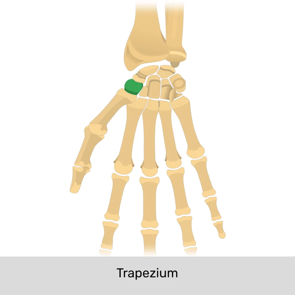 Trapezium Hand Avascular Necrosis Of Trapezium Bone: A Case Report
